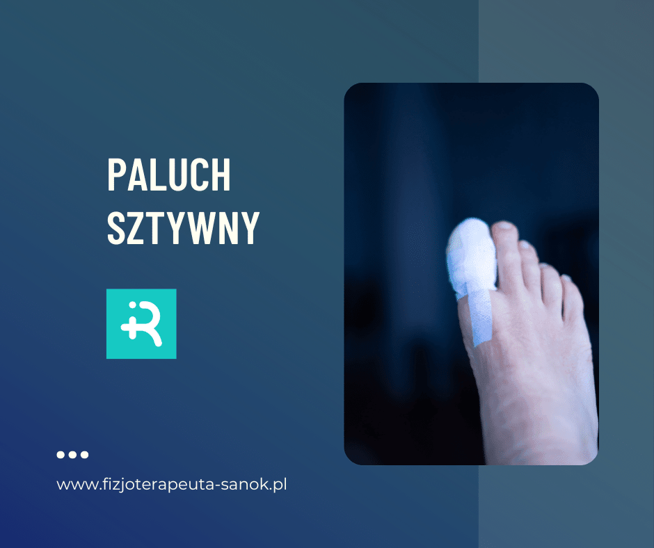 Paluch sztywny: przyczyny, objawy i leczenie – co warto wiedzieć