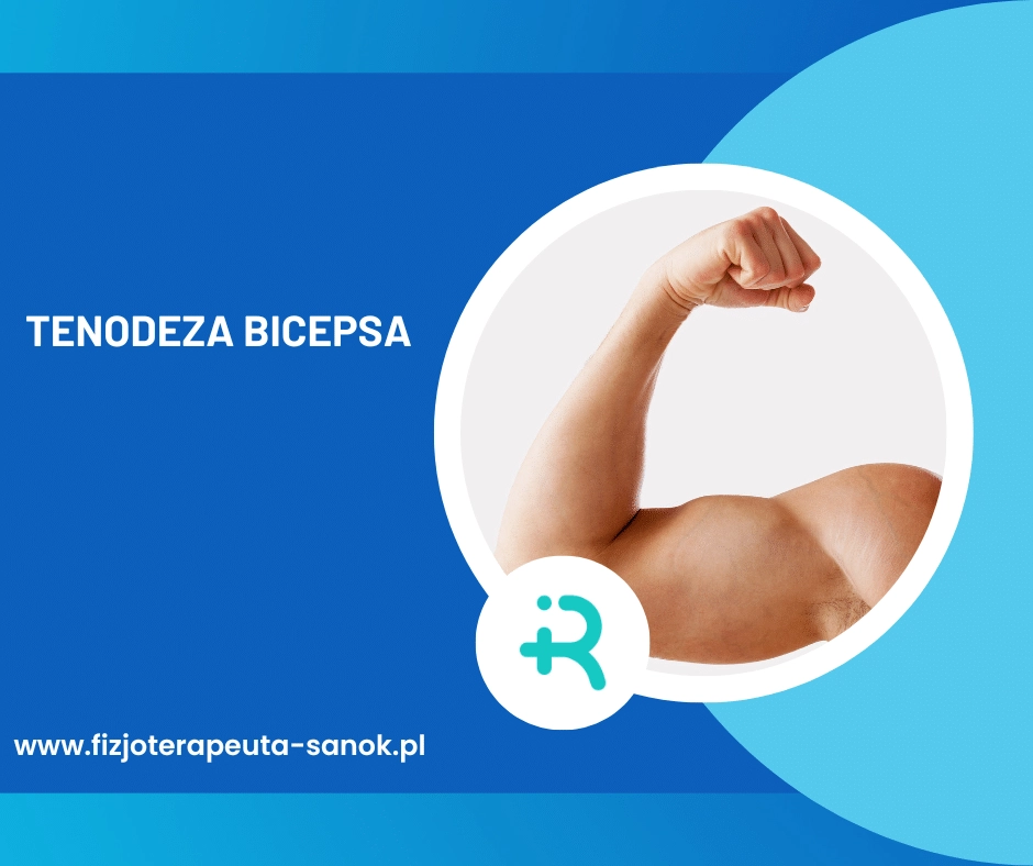 Tenotomia czy tenodeza bicepsa: Którą metodę wybrać?