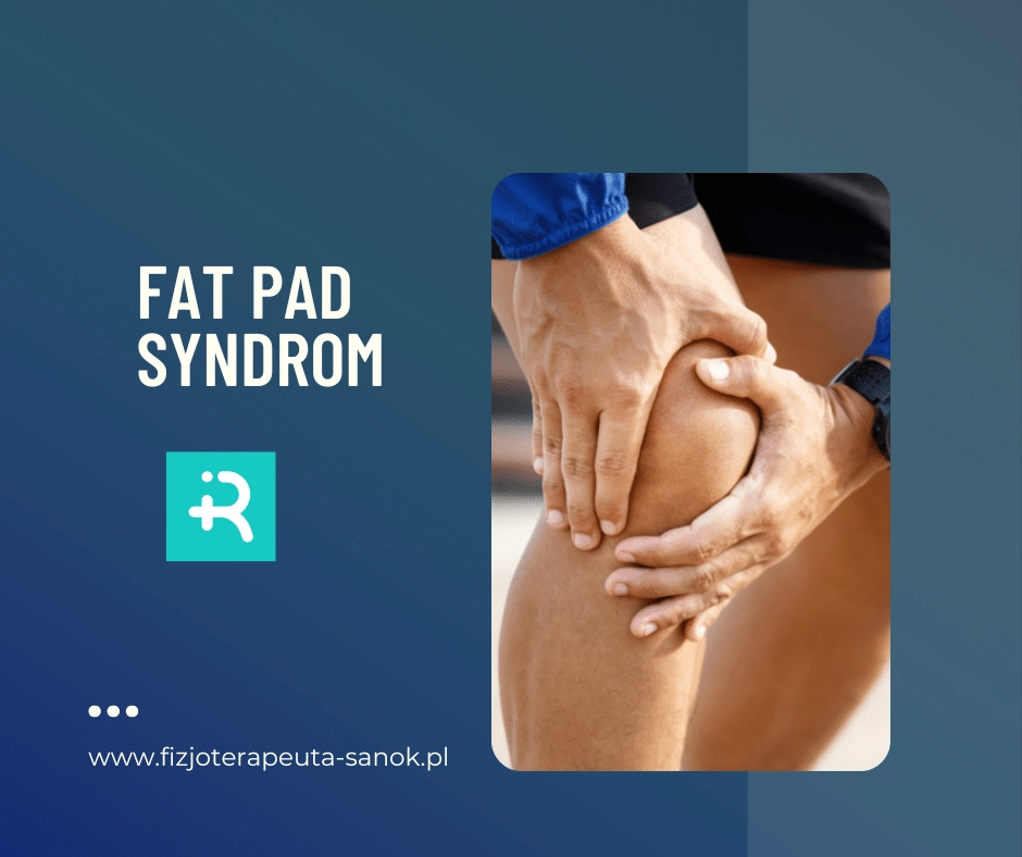 Fat pad syndrom - przyczyny bólu w kolanie i leczenie